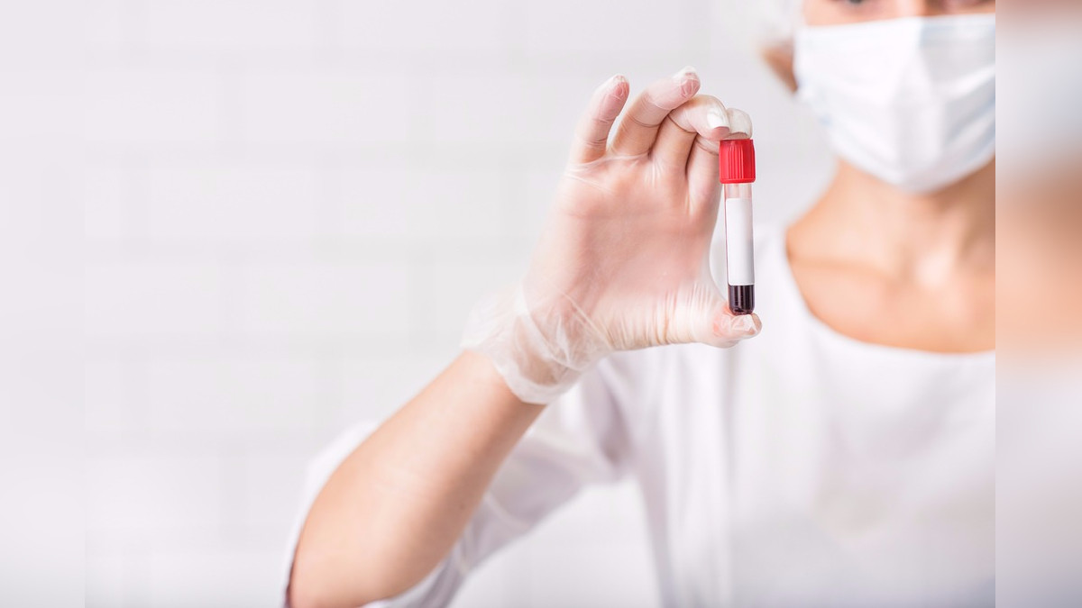 ¿Hasta que nivel de hemoglobina podemos estar hemodinámicamente ...