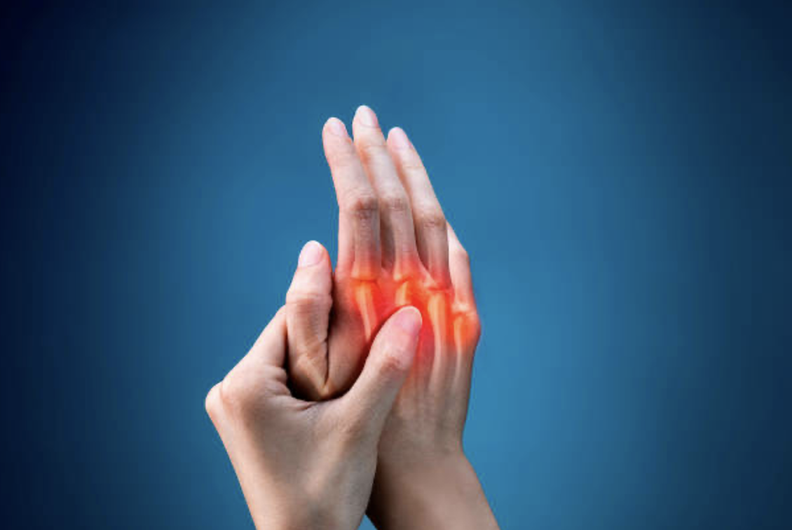 Artritis inflamatoria post COVID-19 - Laboratorio Rontag